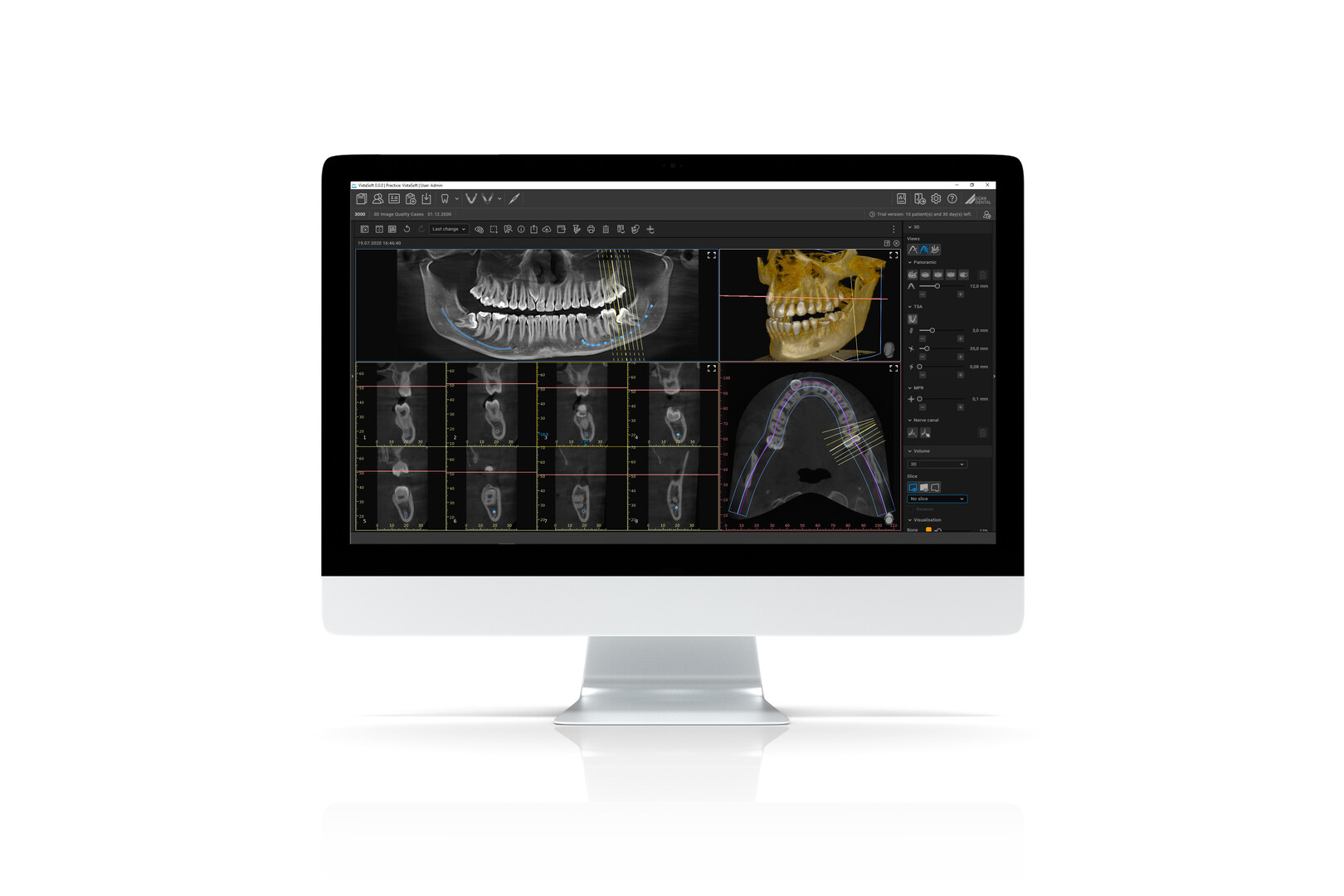 Vistasoft AI included - artificial intelligence for quality and efficiency