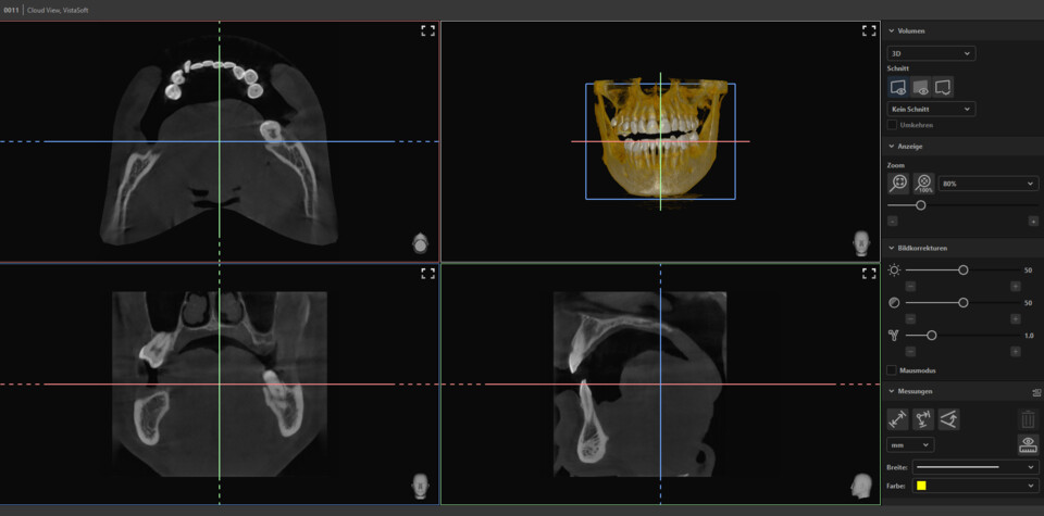 Optimization of dental imaging in the cloud