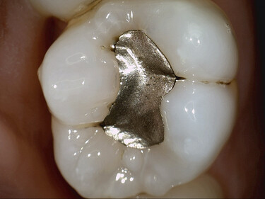 VistaCam camera systems from DÜRR DENTAL