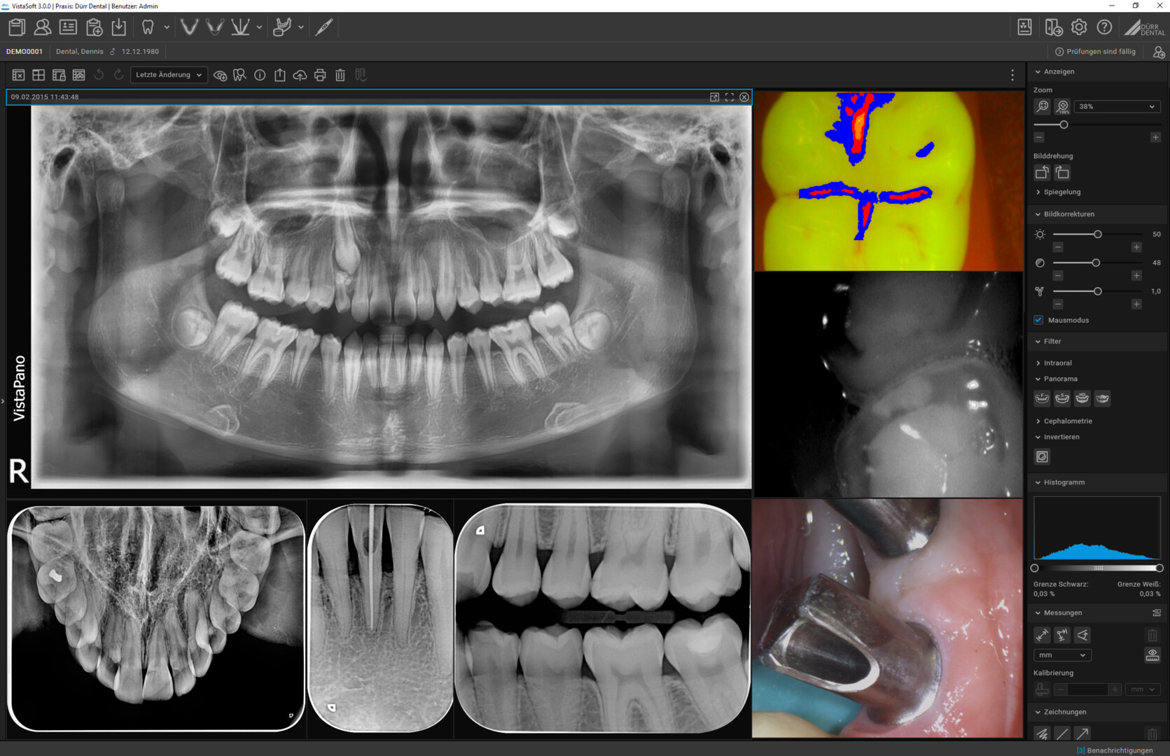 VistaPano S 2.0 | Digital panoramic X-ray device with S-Pan technology
