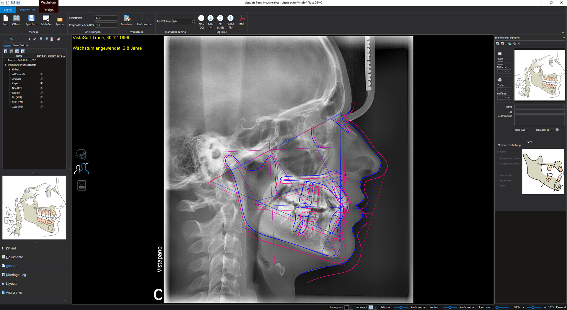 VistaSoft Trace: software solutions for orthodontics