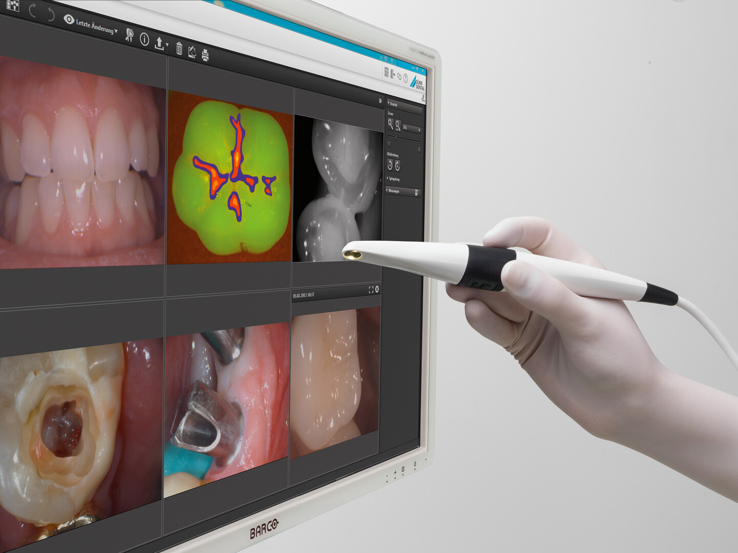 Dental Usb Imaging Software Download – APYTX