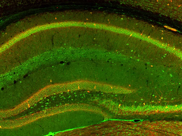 Frontiers | Endoplasmic reticulum and mitochondrial stresses and their ...