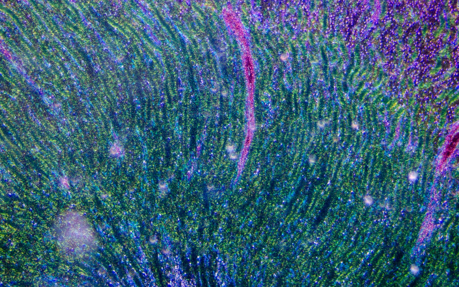 Frontiers in Nephrology