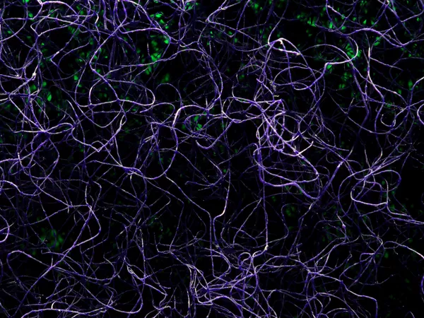 Frontiers | Connectomics of cholinergic circuits: Structural strategies ...