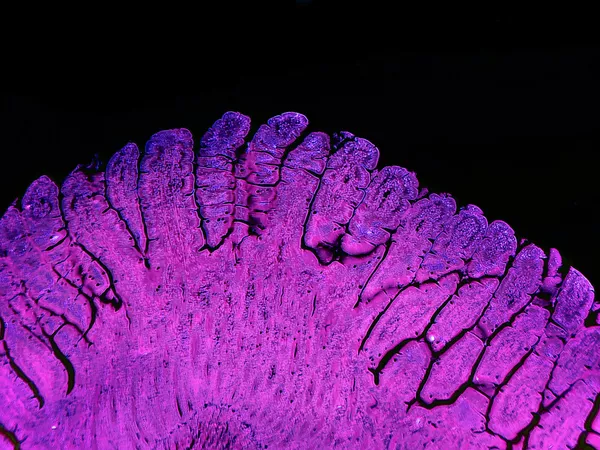 Frontiers | Diagnosis and Management of Pancreatic Cancer