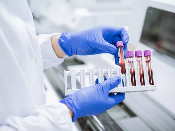 Frontiers | From Donor to Patient: The Science of Safe Blood