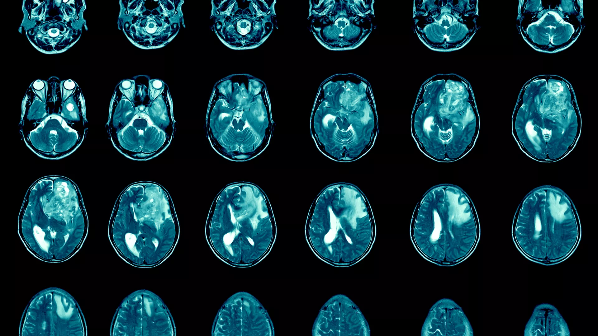 Frontiers in Evolutionary Neuroscience