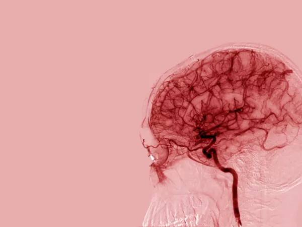 Frontiers | Advances in Mechanical Thrombectomy Devices for Acute ...